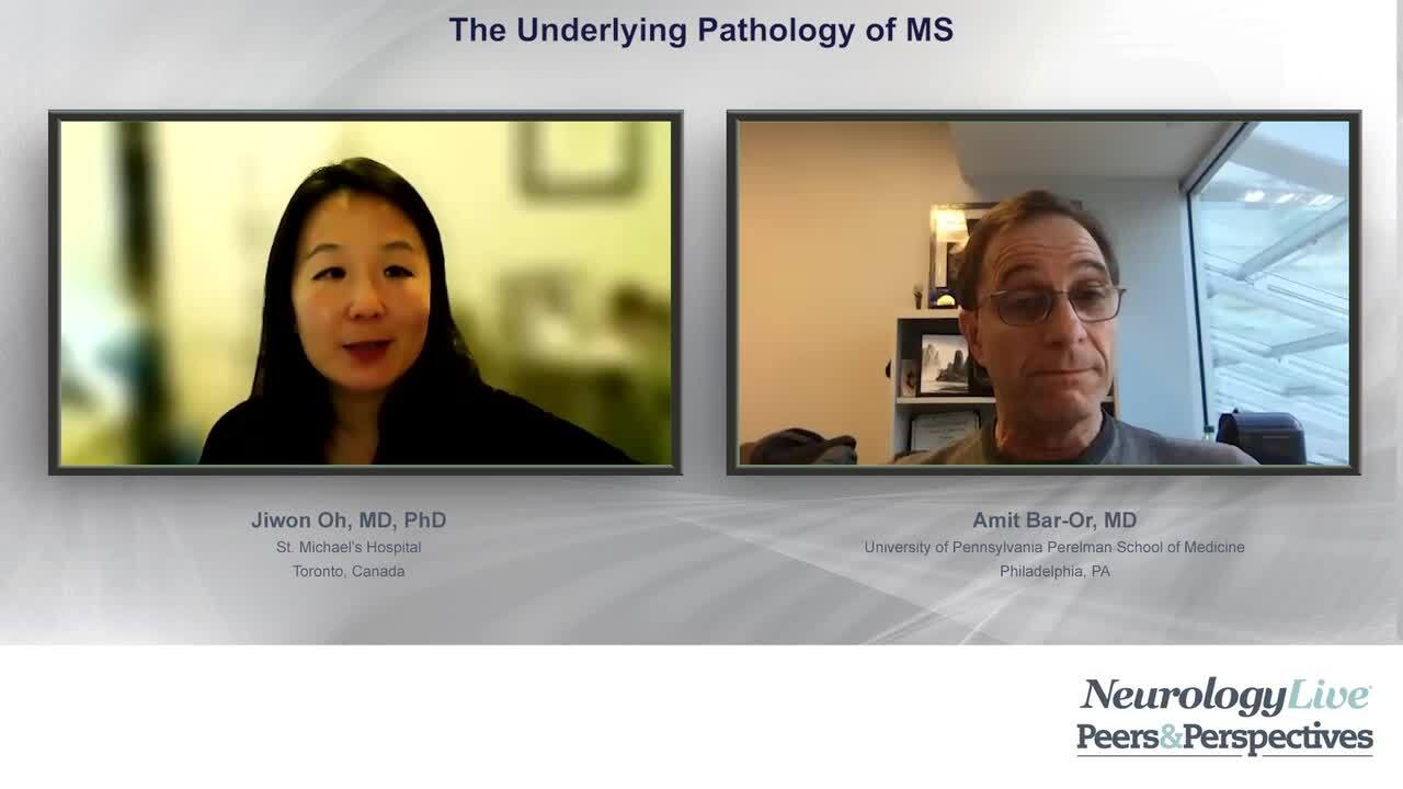 The Underlying Pathology of MS