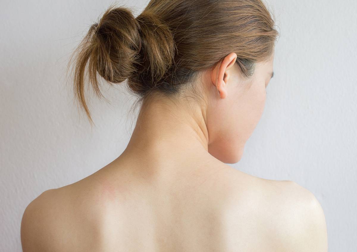 Trapezius Botox: Pros and Cons of the Trending “Trap Tox” | NewBeauty