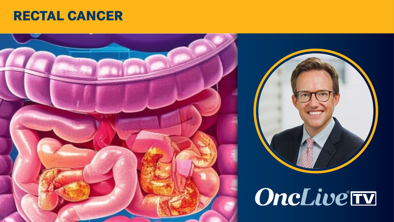 Dr Hall on Addressing Unanswered Questions in Rectal Cancer Treatment ...