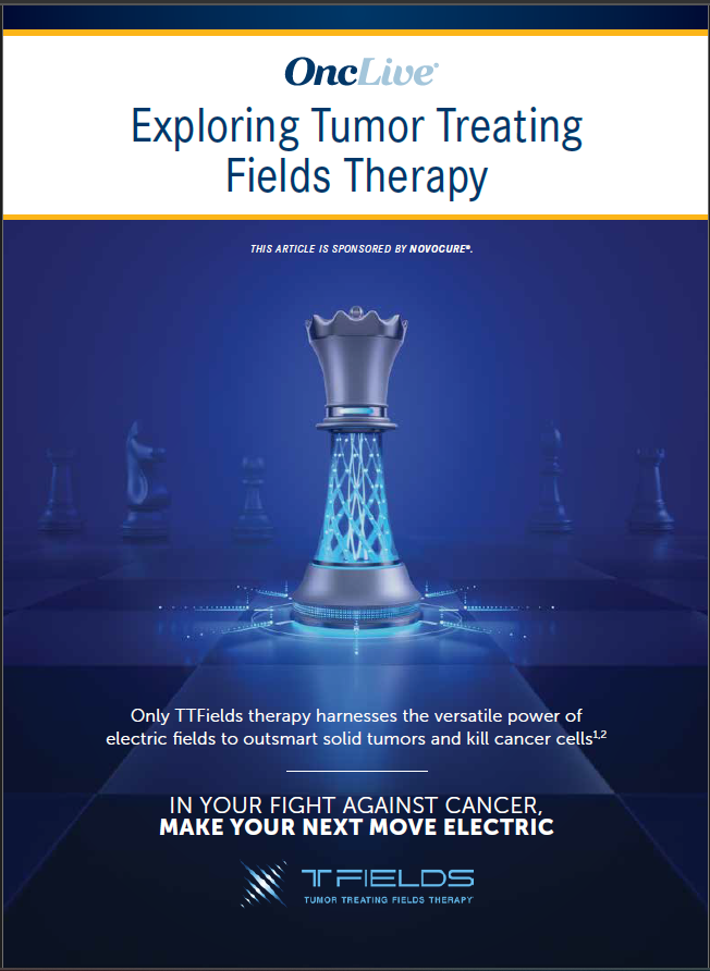 Exploring Tumor Treating Fields Therapy