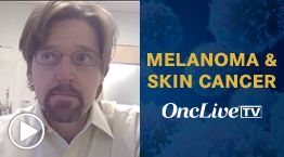 Dr. Sullivan on Future of Triplet Therapies in Melanoma