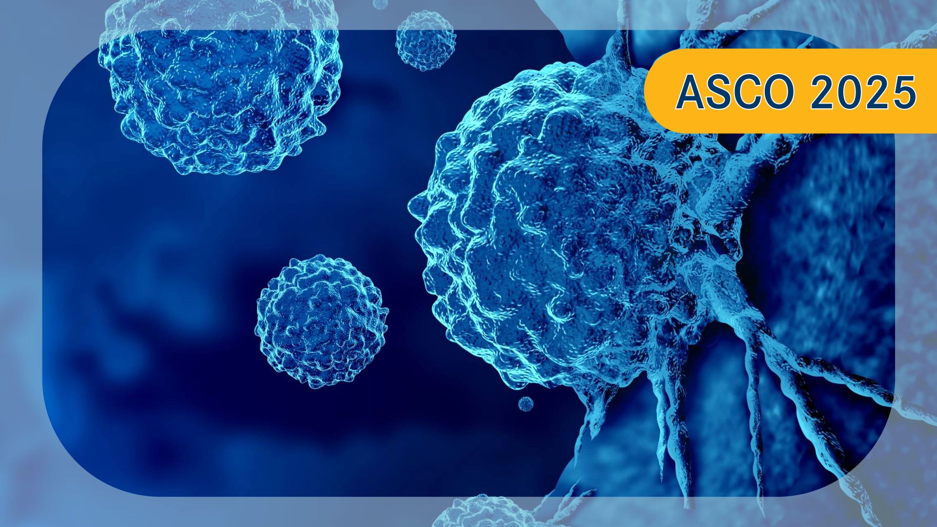 Preoperative PAXG Extends EFS in Resectable and Borderline Resectable ...