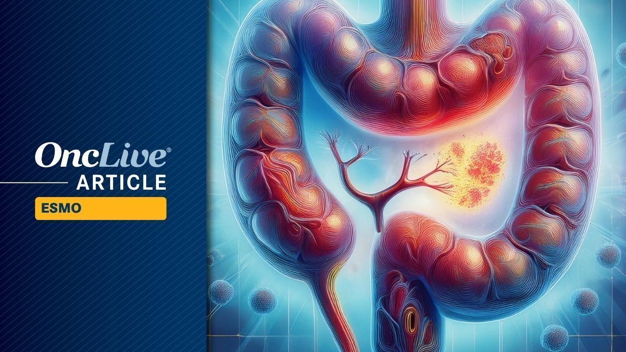 CheckMate 8HW Data Further Support Nivolumab/Ipilimumab as a SOC Option ...