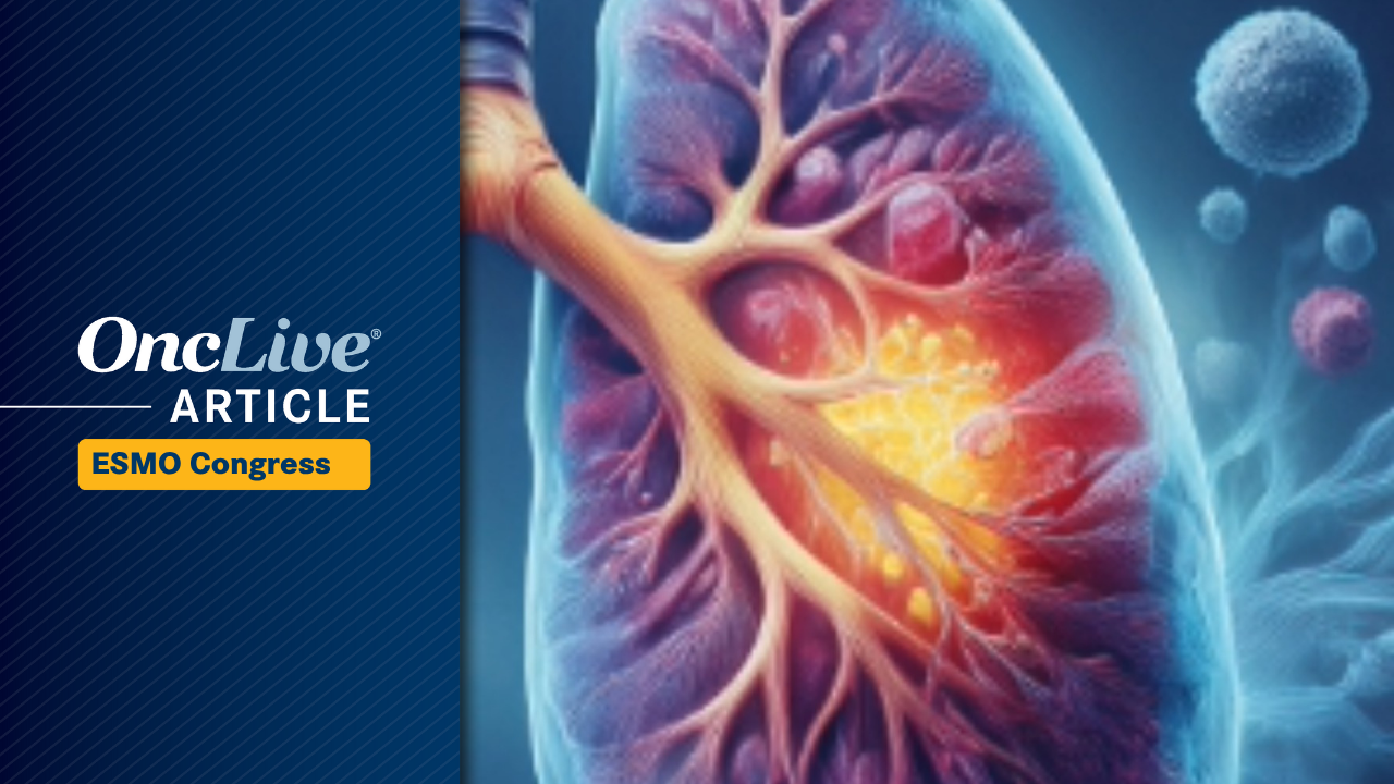 Inside the Most Anticipated Lung Cancer Abstracts: What to Expect From ...