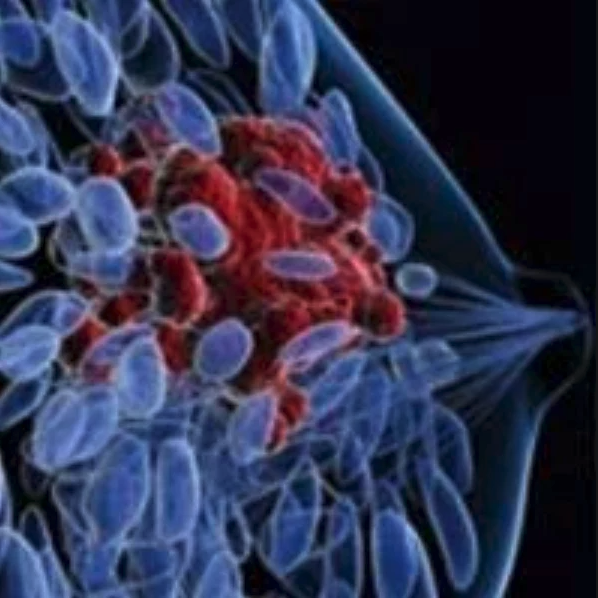 Addition of SDX-7320 to Palbociclib Inhibits Tumor Growth in Breast ...