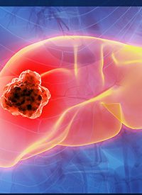 Botensilimab Plus Balstilimab Elicits Durable Responses in Treatment ...