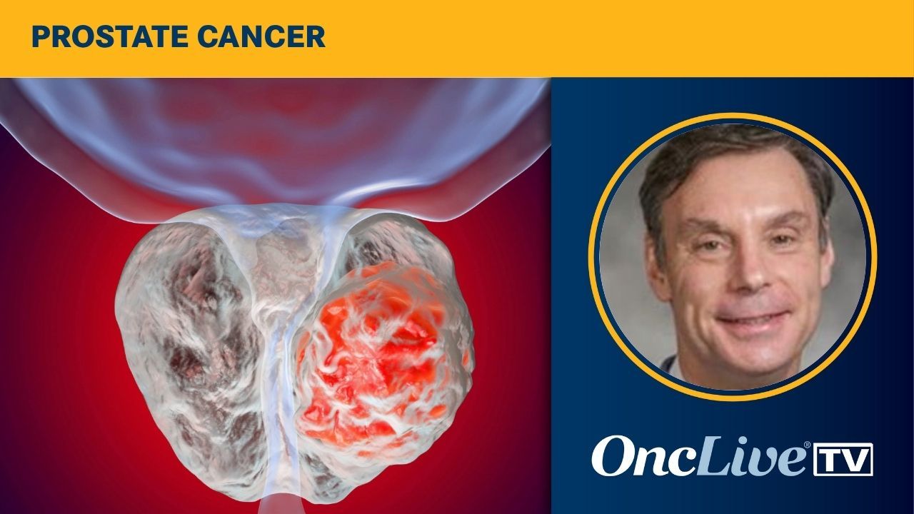 Dr George on the Role of Radioligand Therapy in Prostate Cancer ...