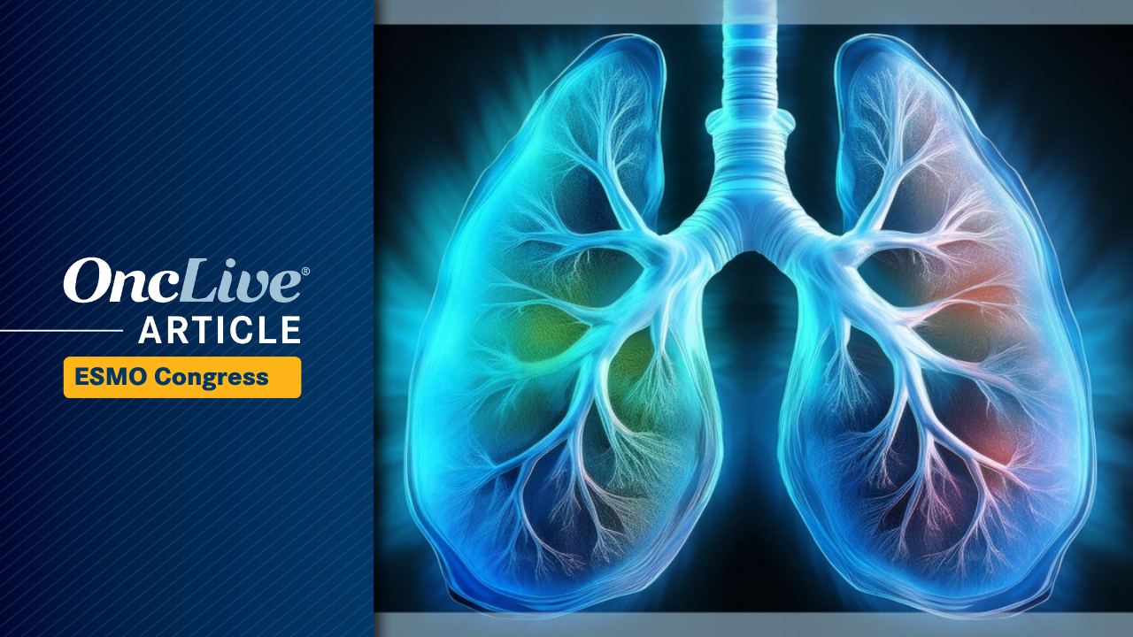 Countdown to ESMO 2025: Catch Up on OncLive’s Extensive Tumor-Specific ...
