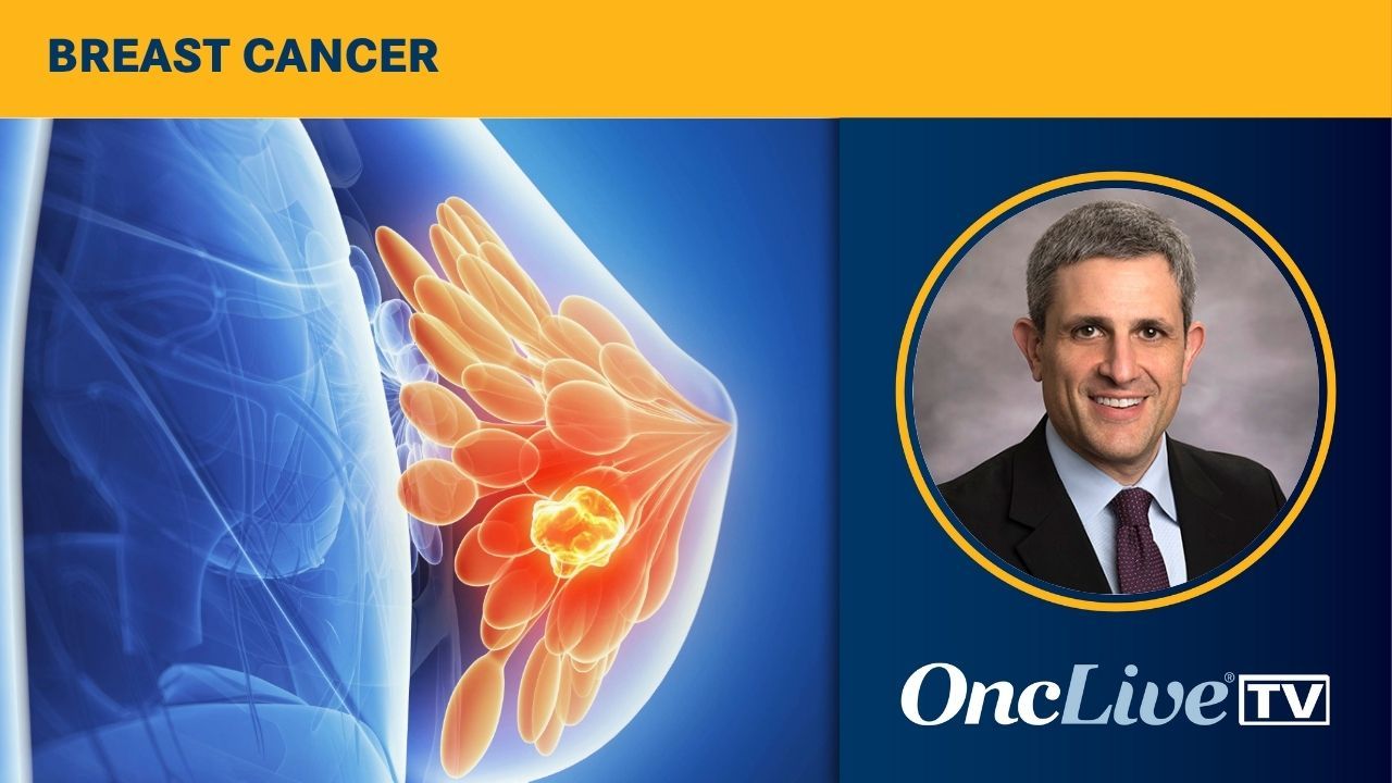 Dr Kalinsky on the Medical Oncologist’s Role Within Integrative Breast ...