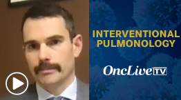 Dr. Ivanick on Advances in Interventional Pulmonology