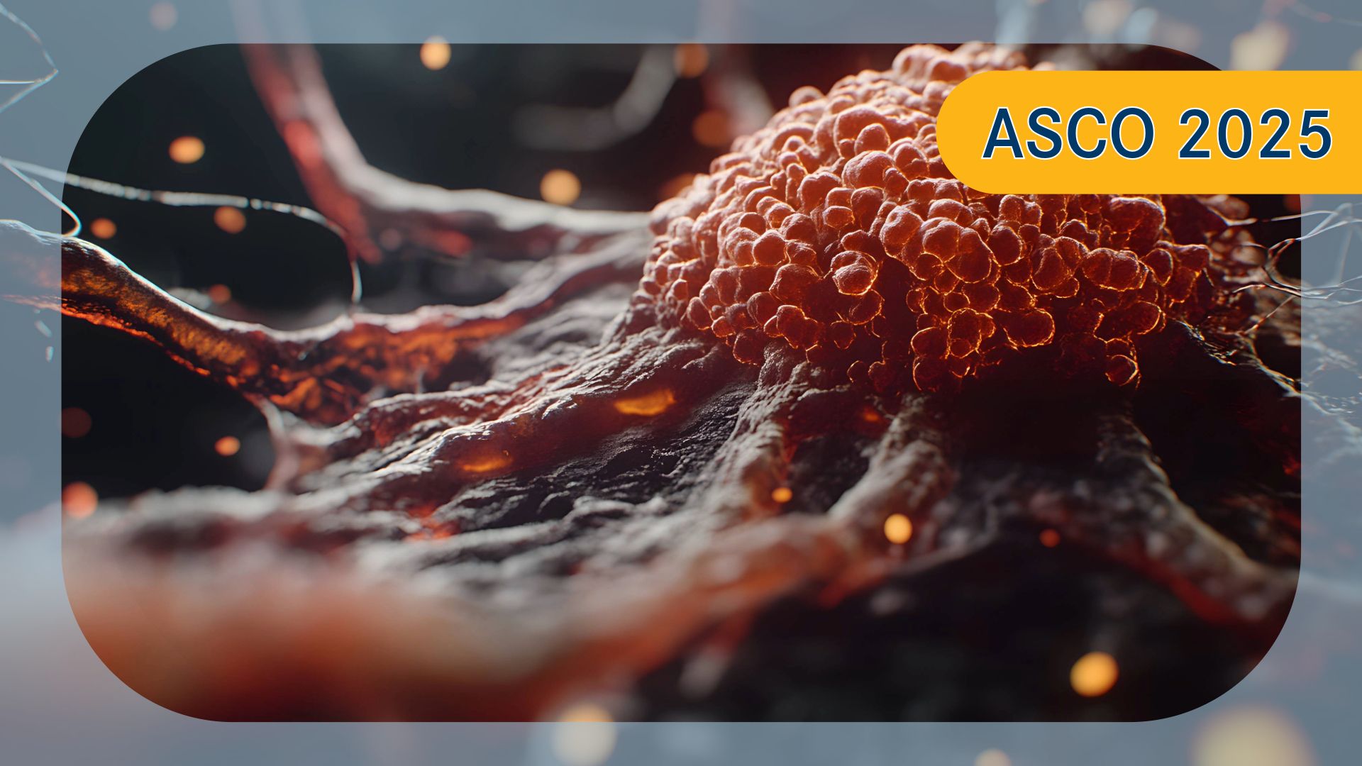 Nivolumab Alone, With Ipilimumab Demonstrate Sustained 10-Year Survival ...