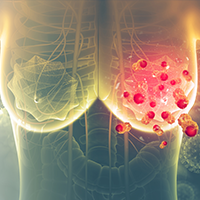 Neoadjuvant KN026 Plus Docetaxel Demonstrates Early Activity in HER2 ...