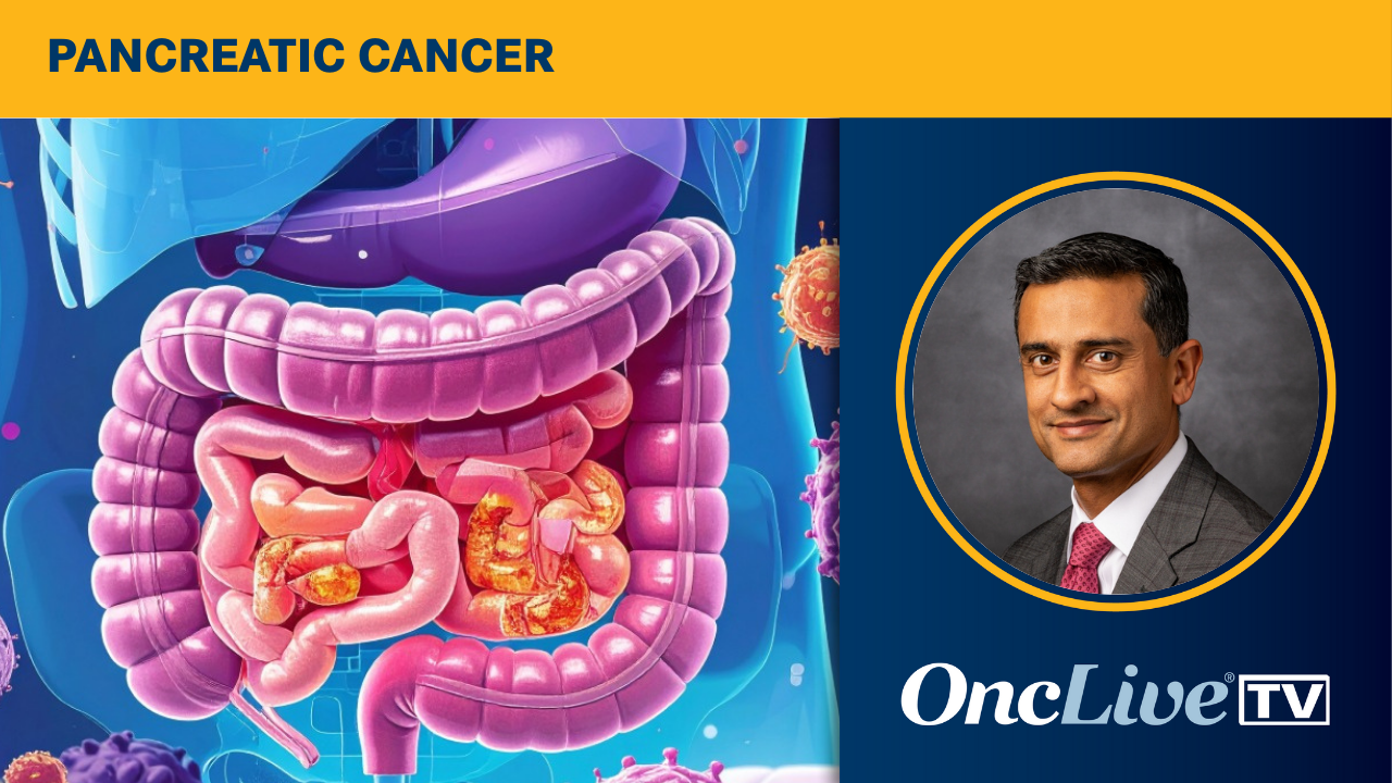 Dr Pant on the Integration of NALIRIFOX Into the Frontline Metastatic ...