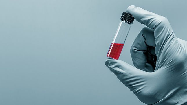 Liso-Cel Demonstrates Durable Responses in Heavily Pretreated, High ...