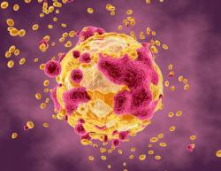 FDA Approves Tebentafusp to Treat HLA-A*02:01 Positive Uveal Melanoma