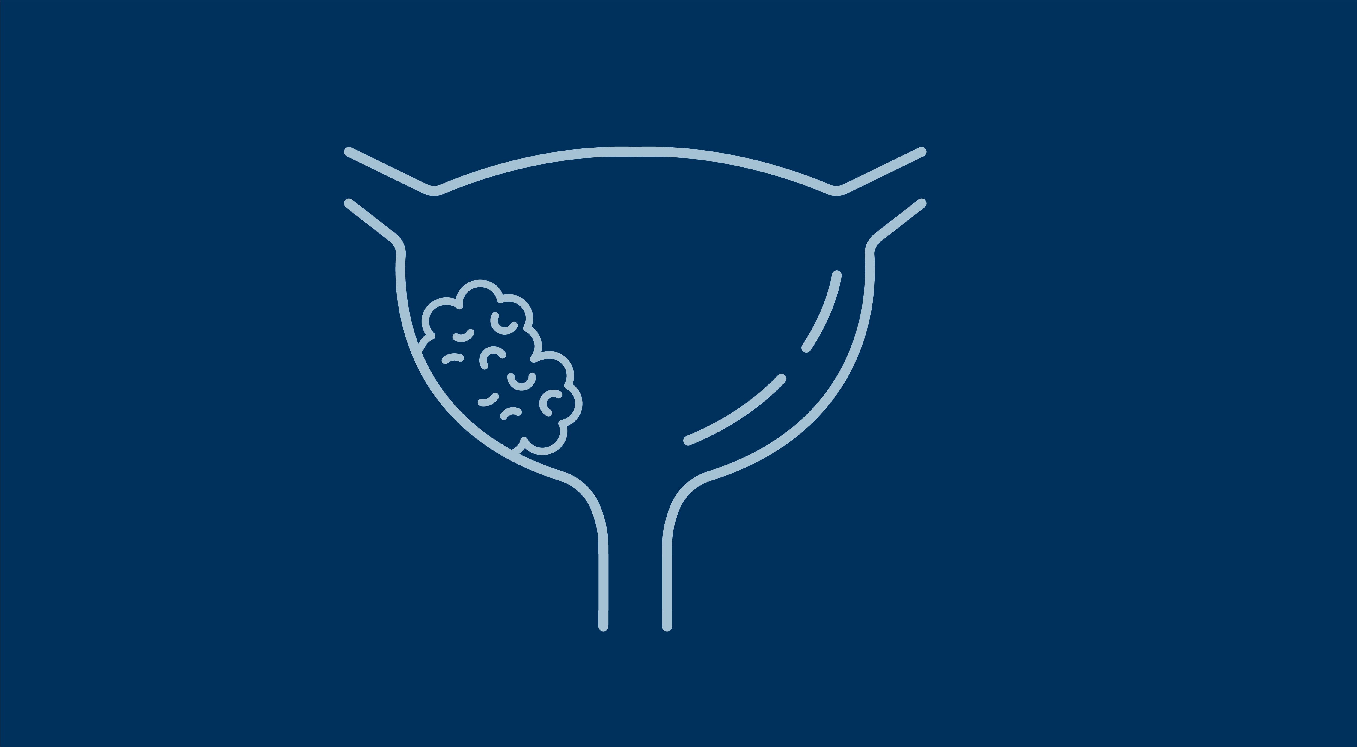 Neoadjuvant TAR-200/Cetrelimab Combo Generates Responses in Muscle ...