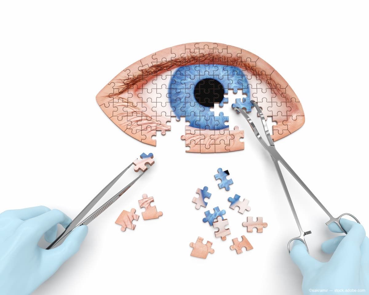 Treatment challenges in patients with nAMD | Ophthalmology Times ...