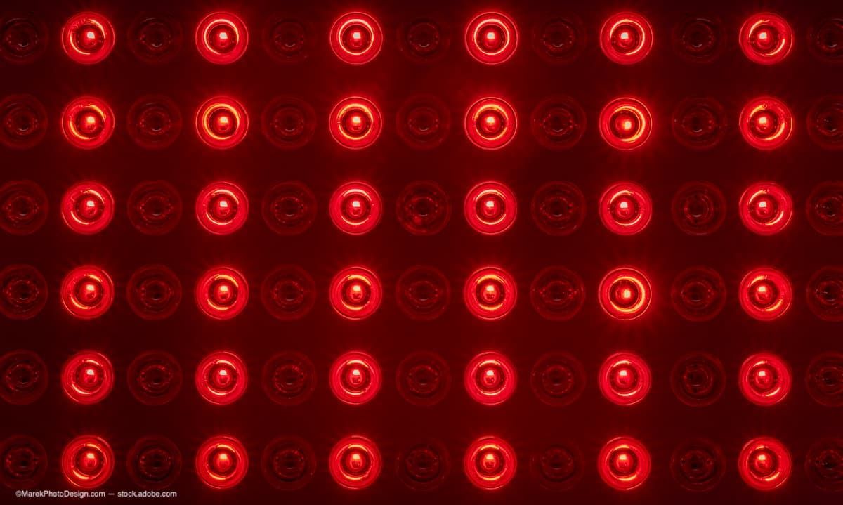 Researcher: Red light myopia therapy can injure retina | Ophthalmology ...