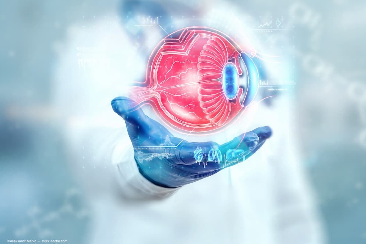 Improving lens feathering during vitrectomy | Ophthalmology Times ...