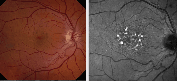 Imaging | Ophthalmology Times