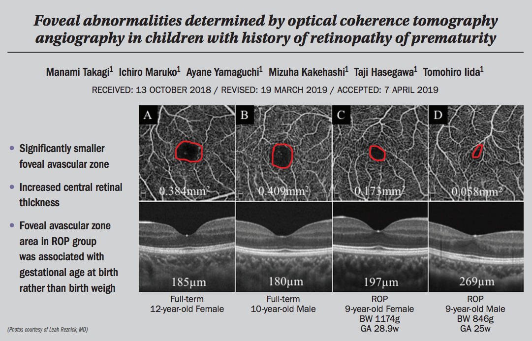 Octa A Hope For Diagnosing Managing Ophthalmic Diseases
