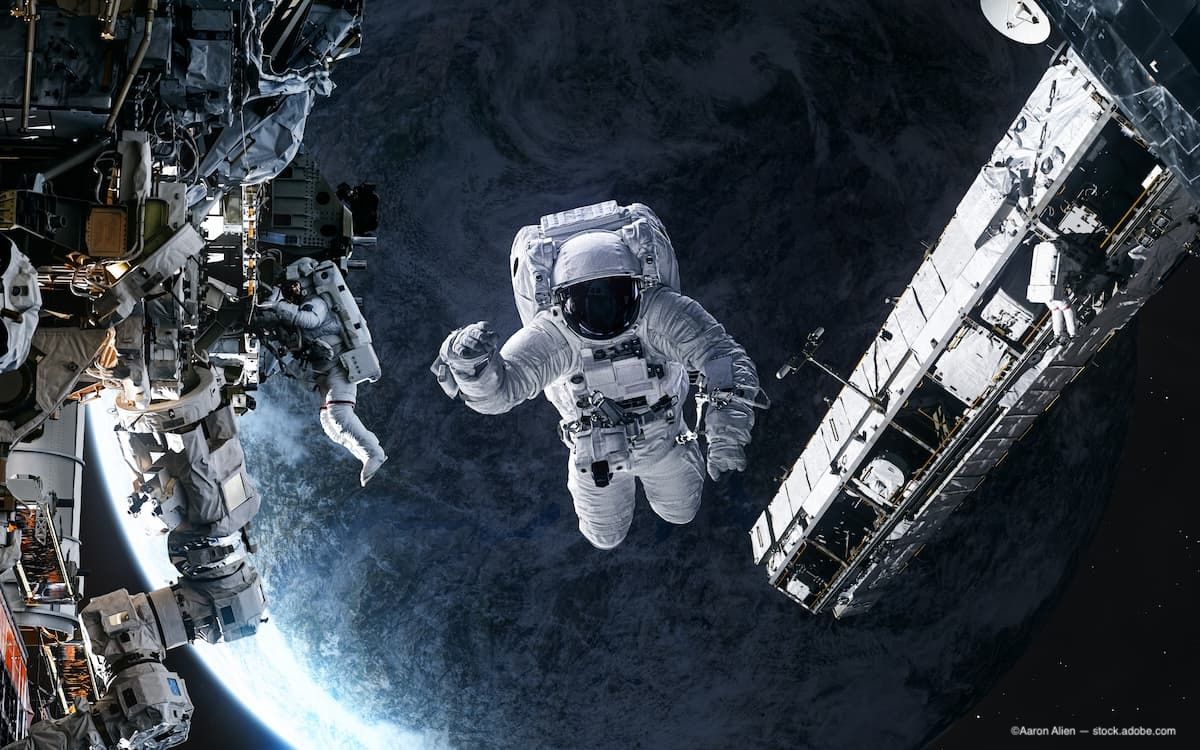 Potential risk factors for severe Spaceflight-Associated Neuro-Ocular ...