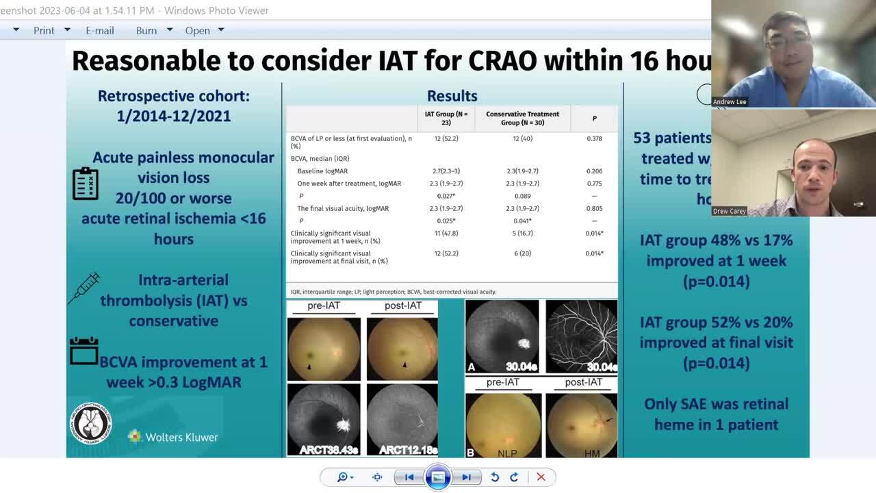 NeuroOp Guru: Intra-arterial thrombolysis for central retinal artery ...