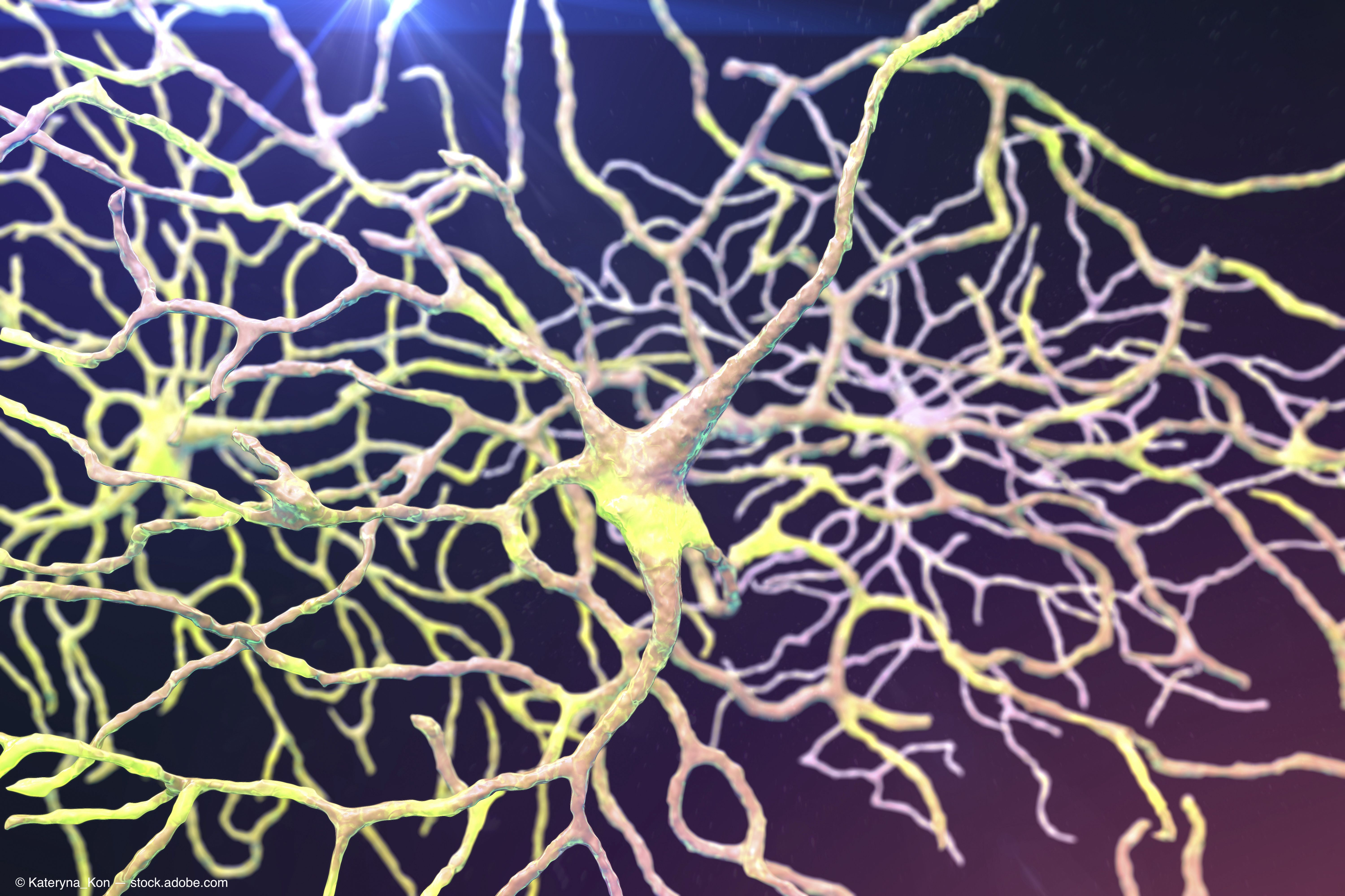 Addressing GA by downregulating overactive complement system ...