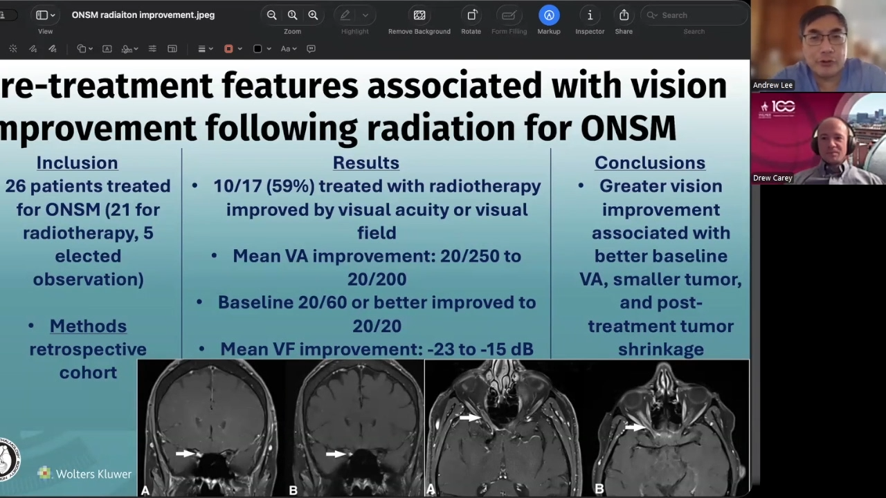 NeuroOp Guru: Predicting which patients regain vision after optic nerve ...
