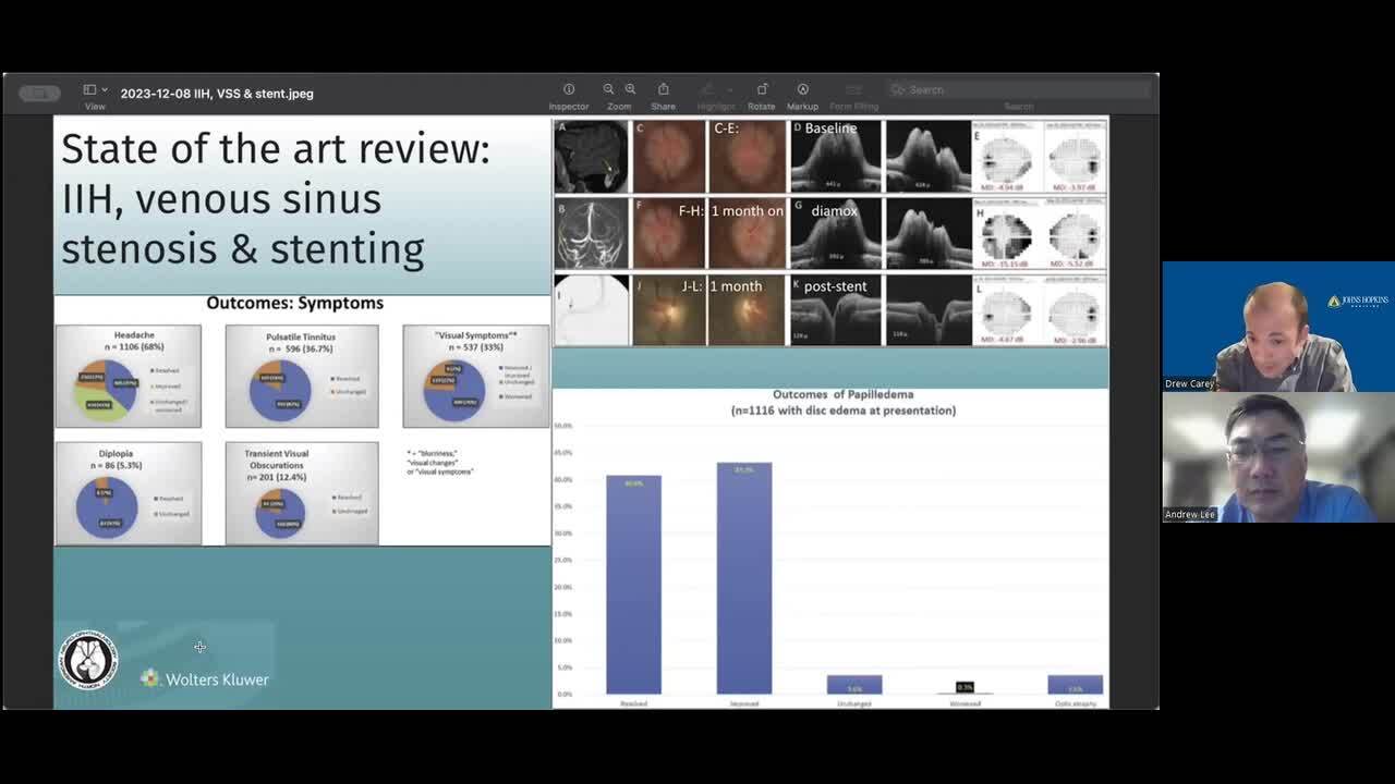 NeuroOp Guru: Venous sinus stenting for idiopathic intracranial ...