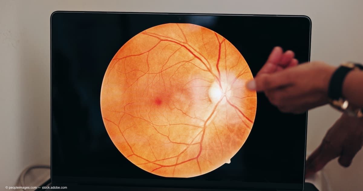 Retinal imaging study suggests new biomarkers for early diabetic ...
