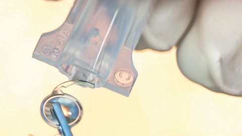 IOL Advances | Ophthalmology Times