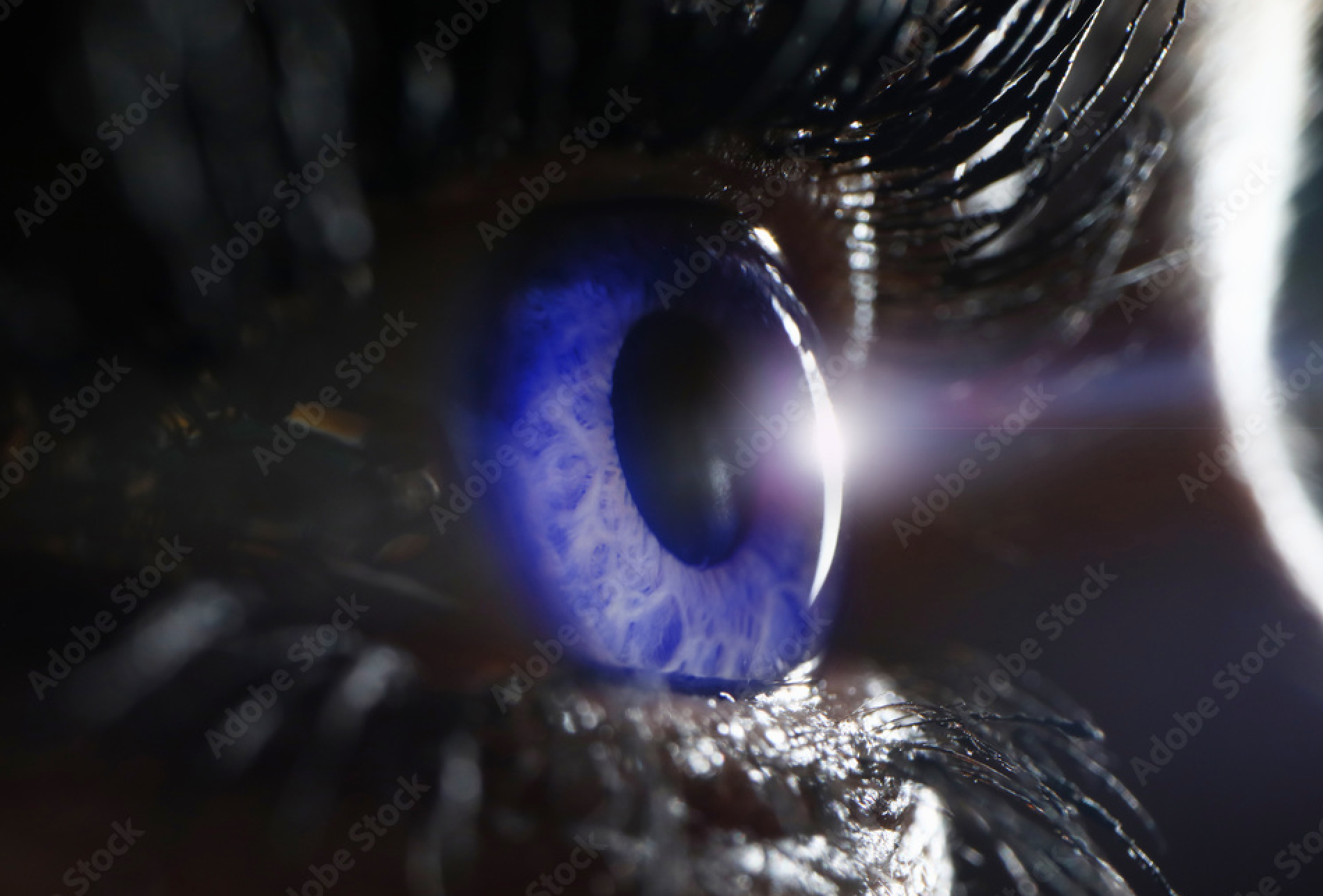 BRIM Biotechnology receives FDA orphan drug designation for treatment ...