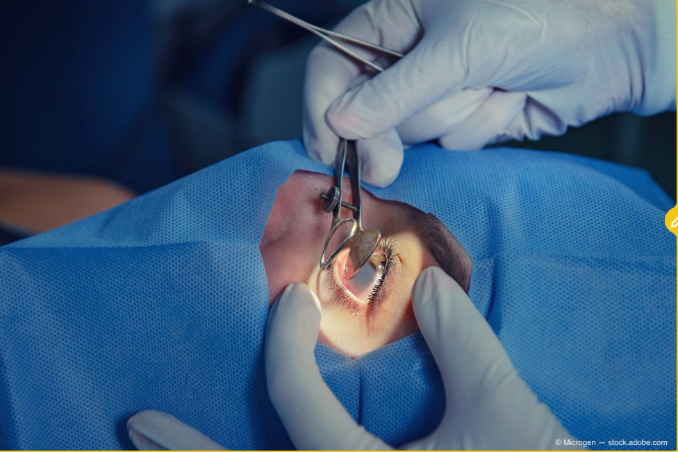 Extended depth-of-field IOLs: Clarifying current nomenclature