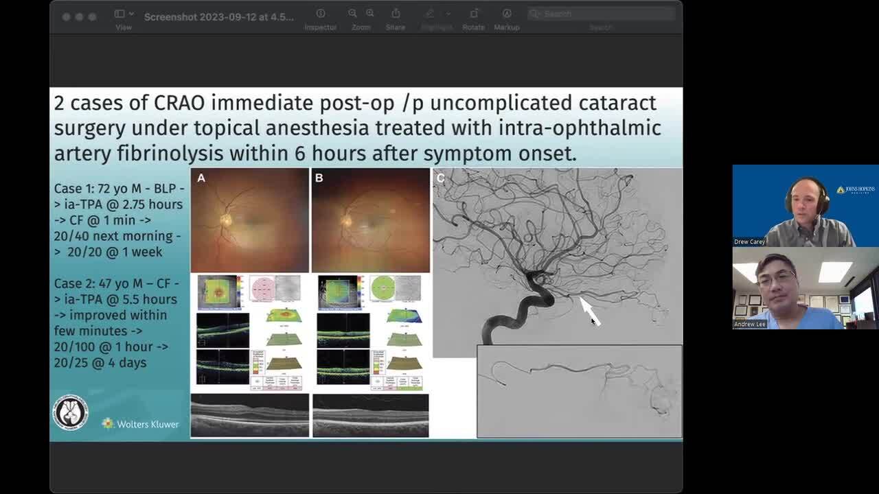 NeuroOp Guru sur 2 cas de CRAO survenus immédiatement après l'opération ...