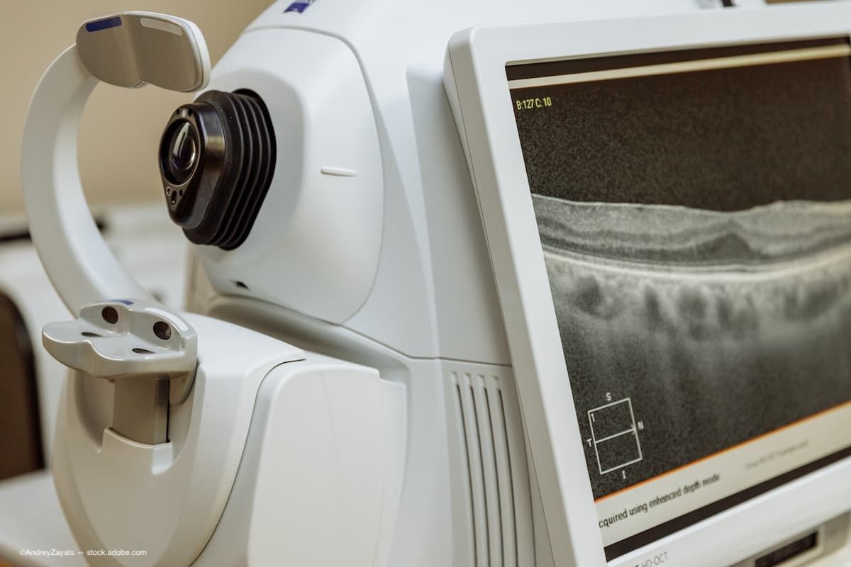 Small Hyperreflective Retinal Foci An In Vivo Imaging Feature Of