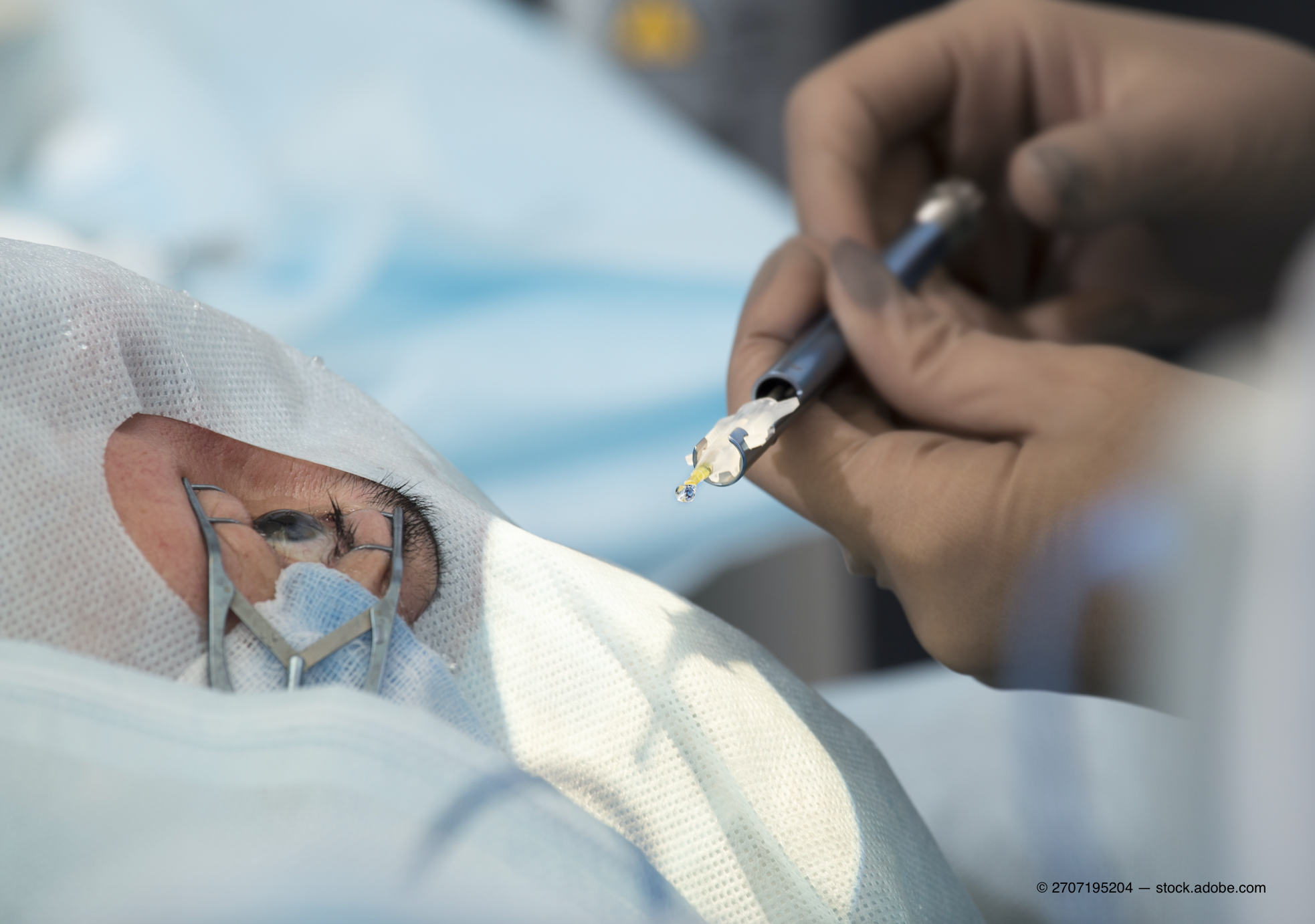 FDA approves Eyenovia’s APP13007 for relief of pain, inflammation after ...