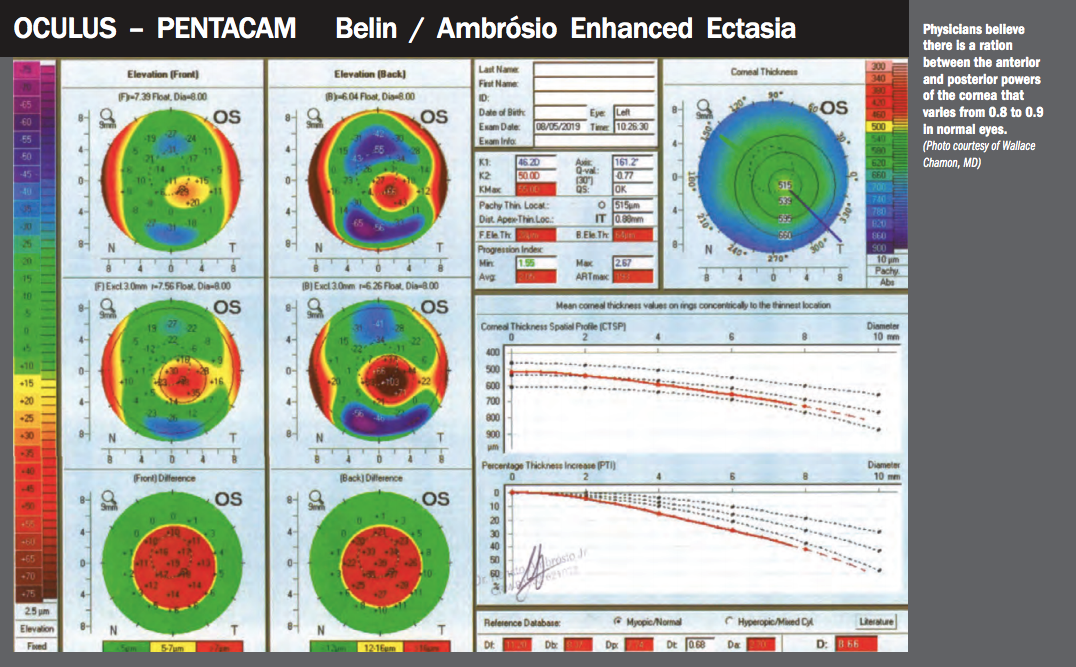 Estimating the total corneal power key in keratoconus patients ...