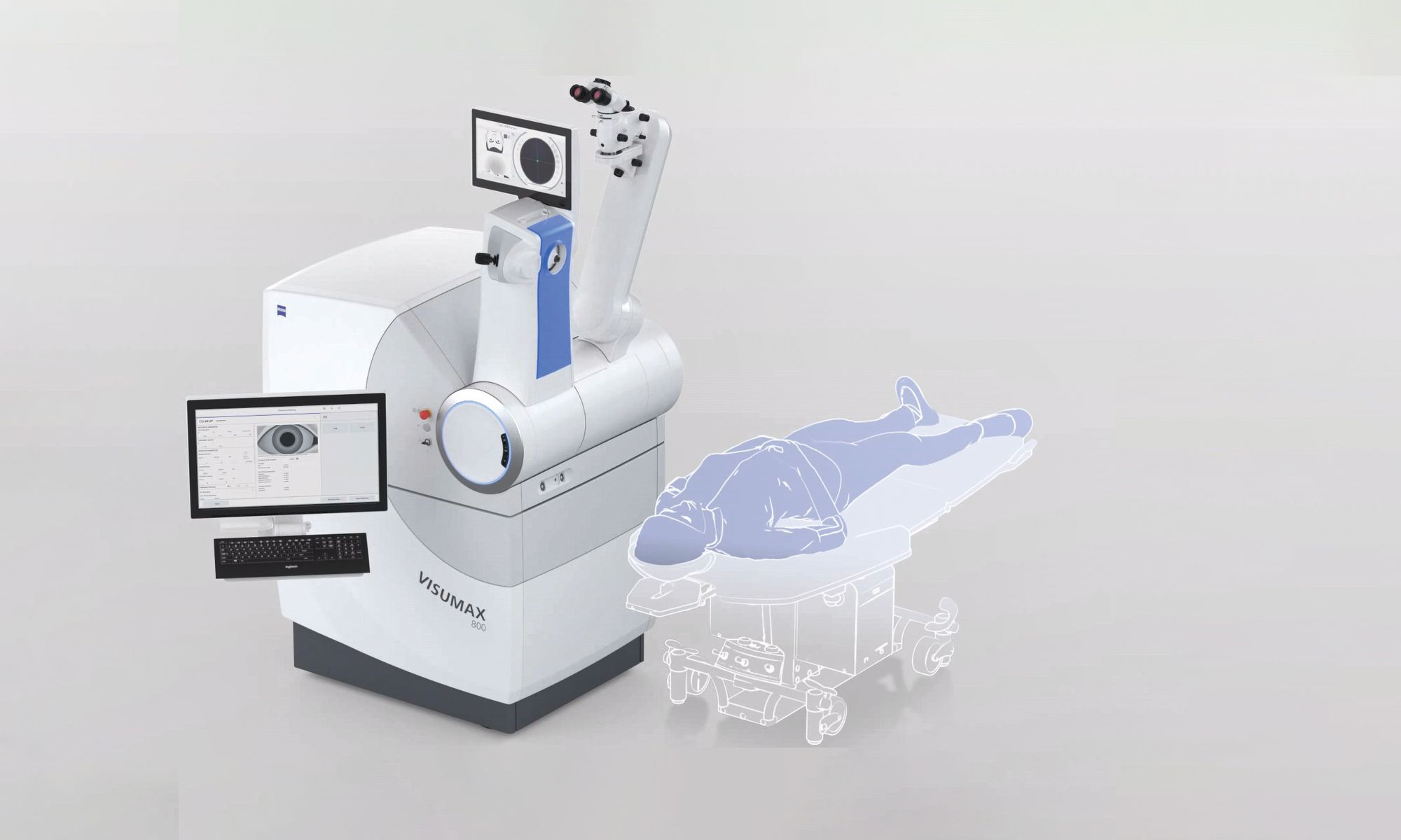 SMILE for myopia and myopic astigmatism – Increasing procedural ease ...