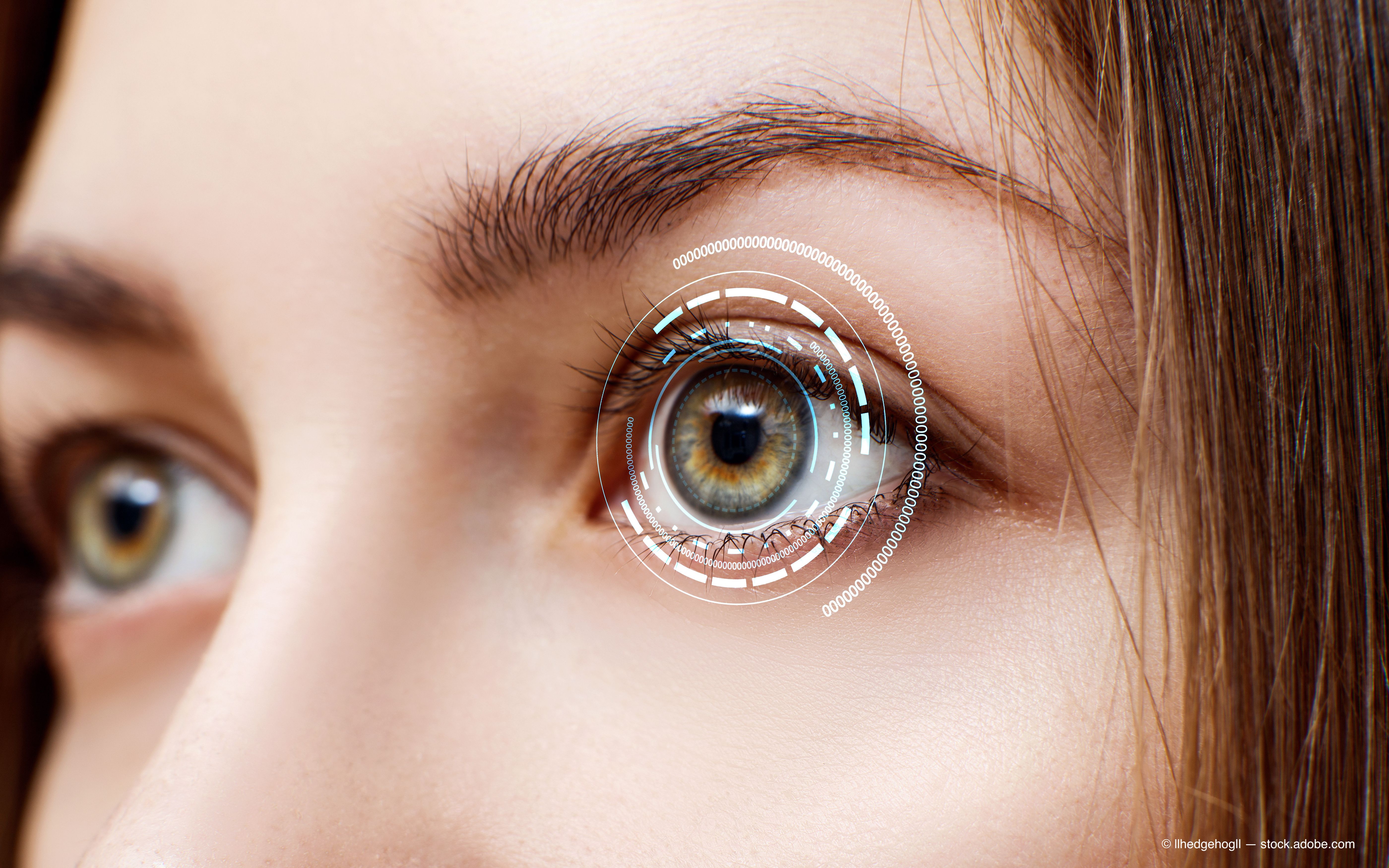 MGD care paradigm shifts with new treatment devices | Ophthalmology ...