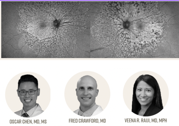 Successful treatment of bilateral diffuse uveal melanocytic ...