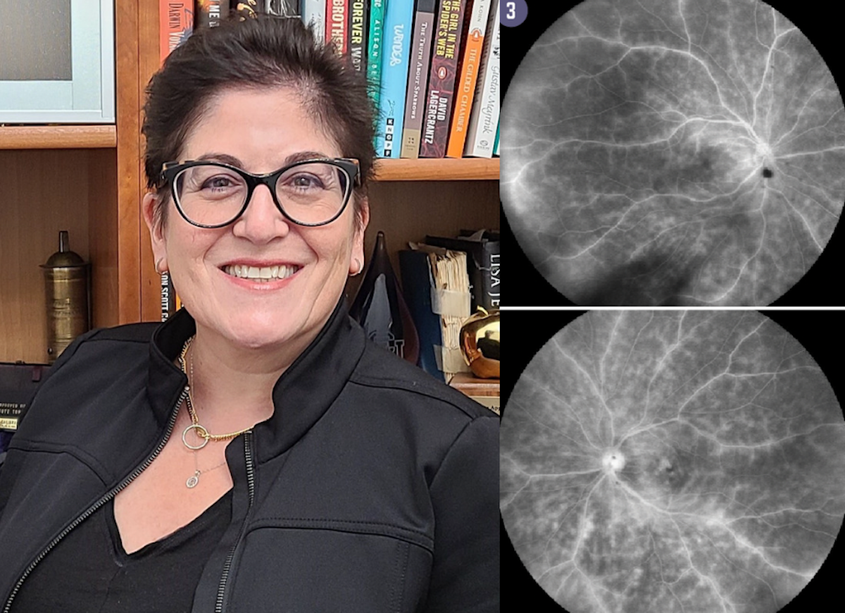 Imaging trends in paediatric uveitis | Ophthalmology Times Europe