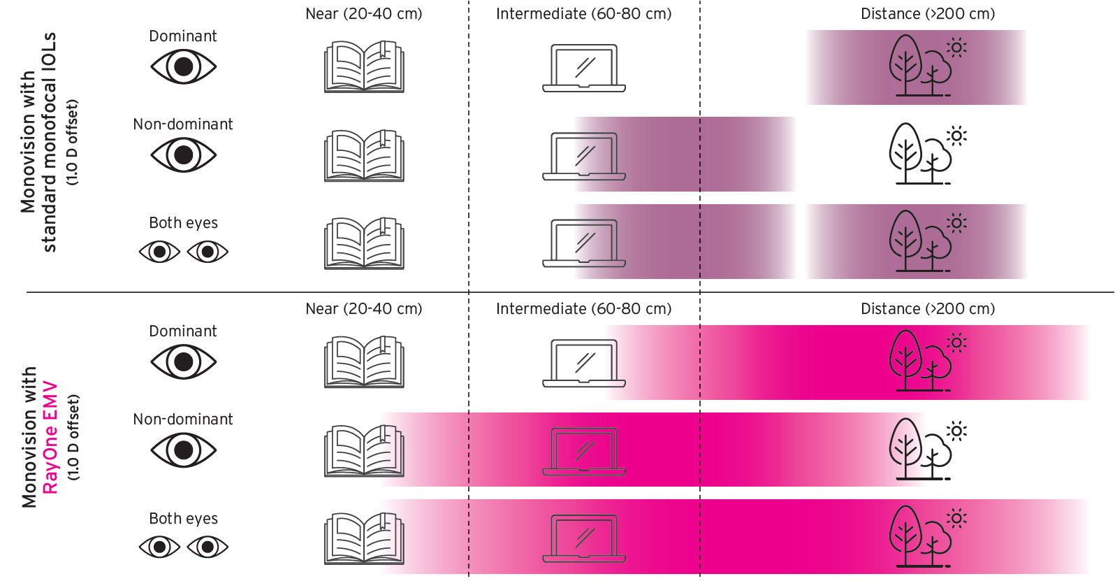 A New Lens Option For Enhanced Monovision Performance