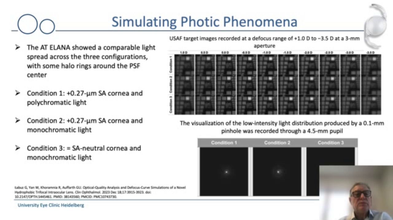Part 3: Optimizing outcome precision with leading edge advanced lens ...