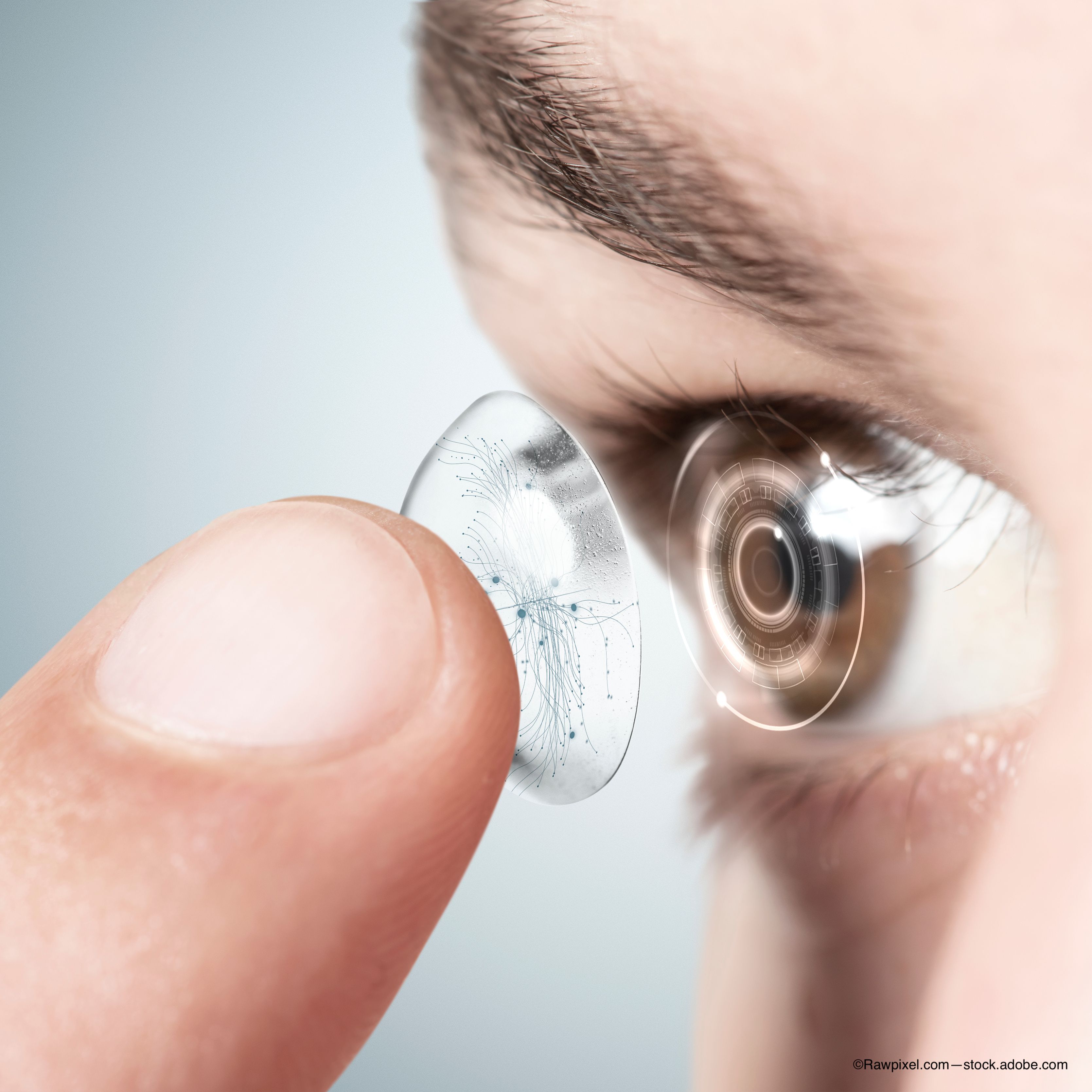 Smart contact lenses show promise for wireless glaucoma detection