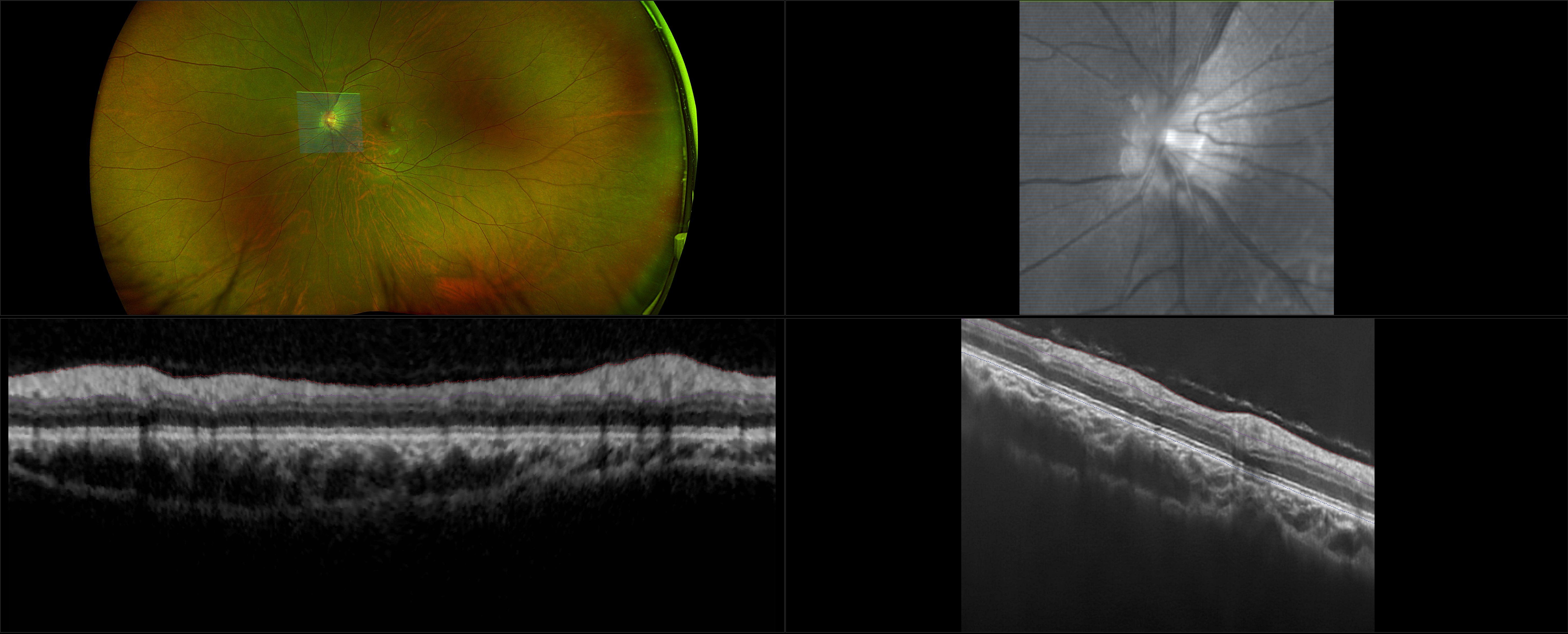 Optos ushers in new generation of imaging with MonacoPro ultra ...