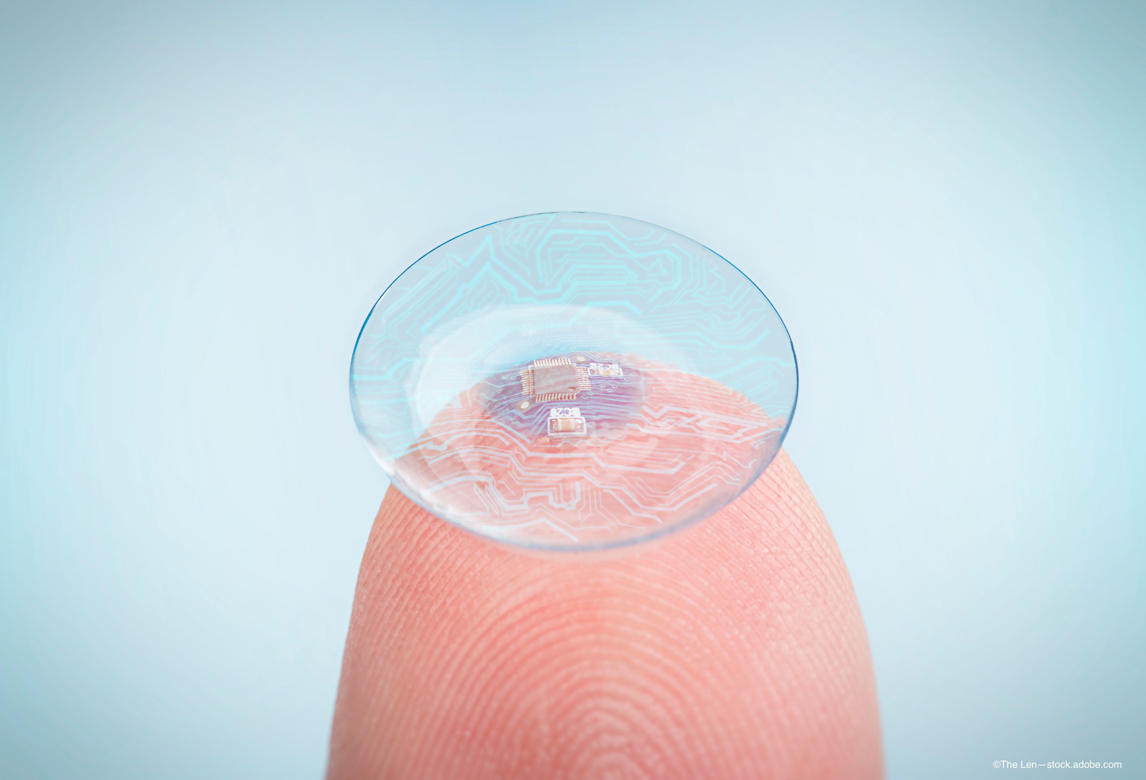 Azalea Vision announces first on-eye test of its smart contact lens ...