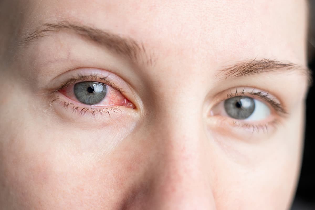 Global review highlights causes, treatments, and gaps in managing ...