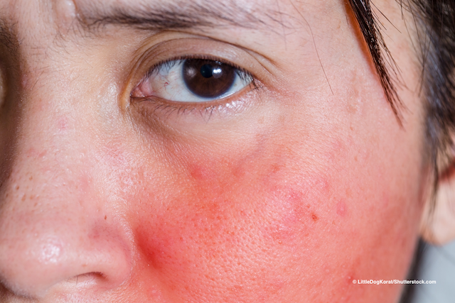 Cosmetic dangers: Part 3-Keep patients informed, report cosmetic problems