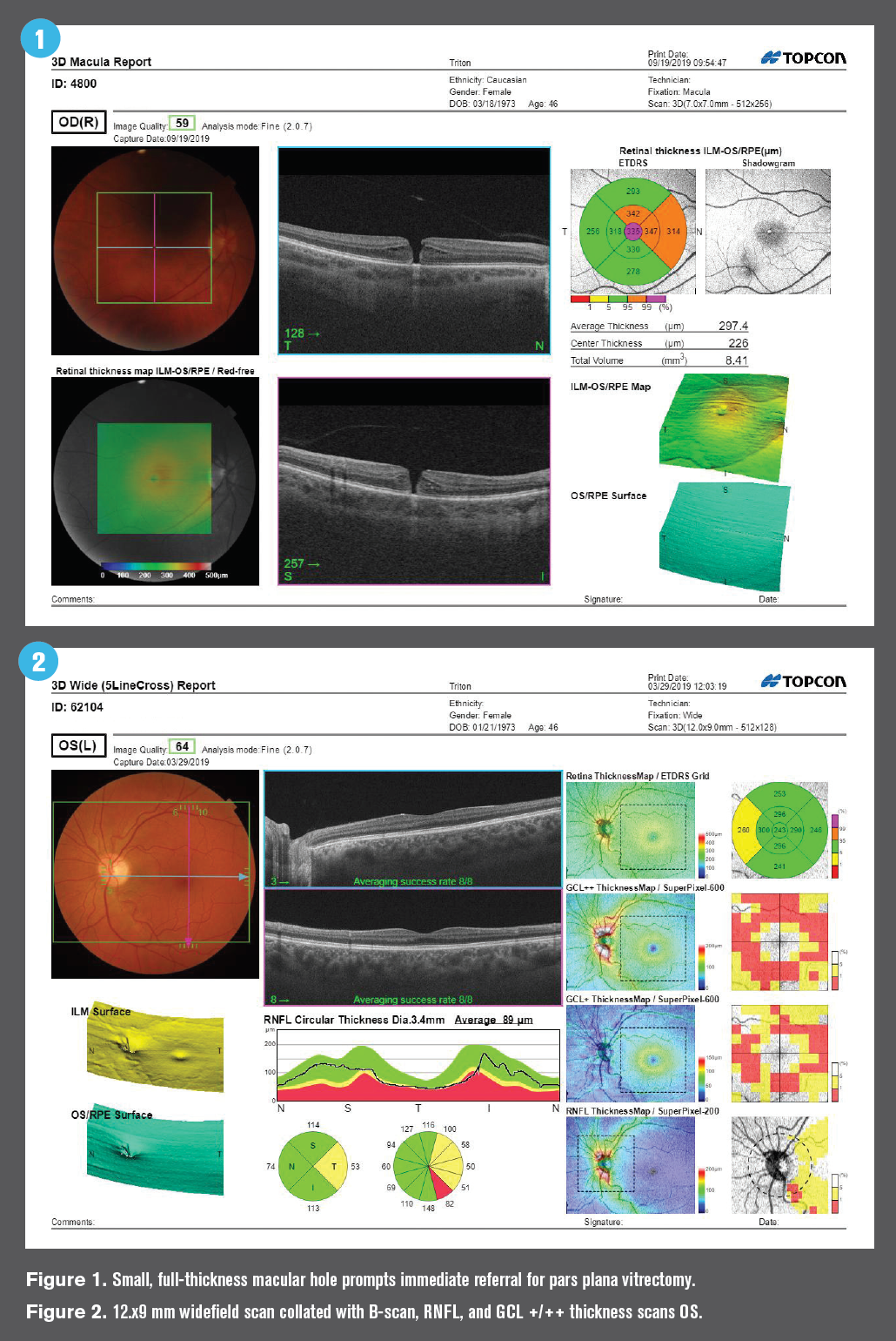 Swept-source and multimodal OCT technologies offer clinical advantages ...